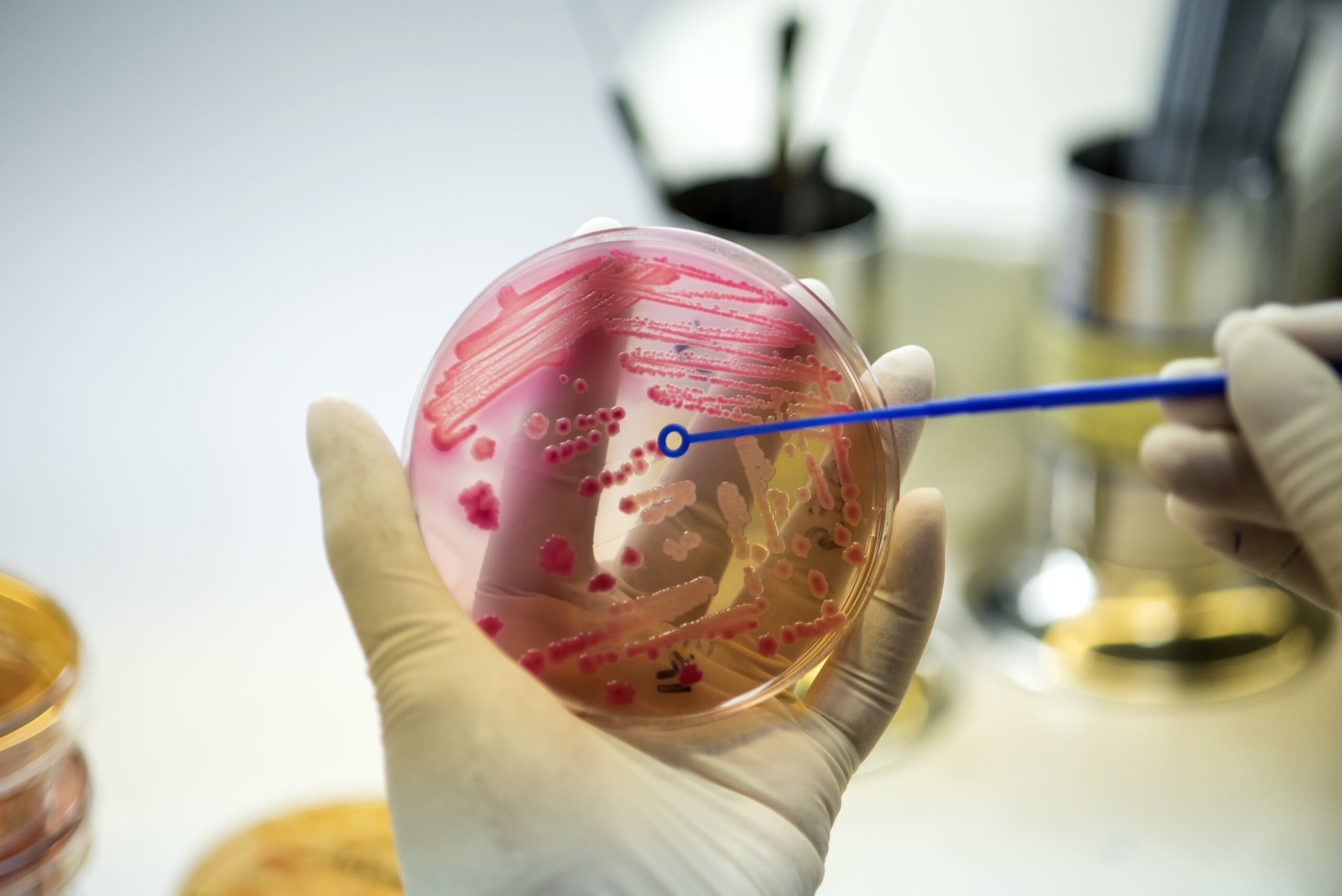 TS Lab – Uji Lab Terpercaya di Jakarta